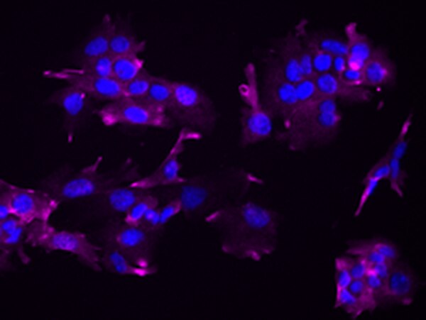 MOC22 Mouse Oral Squamous Cell Carcinoma (OSCC) Cell Line | SCC471
